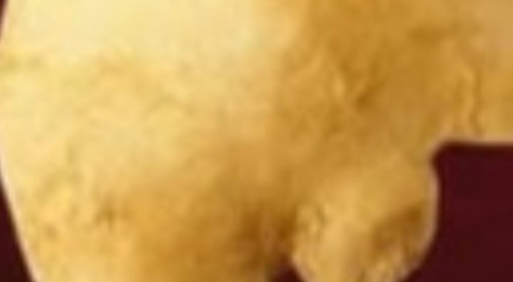 Spices To Clean Arteries And Prevent Heart Attacks Easy Recipes